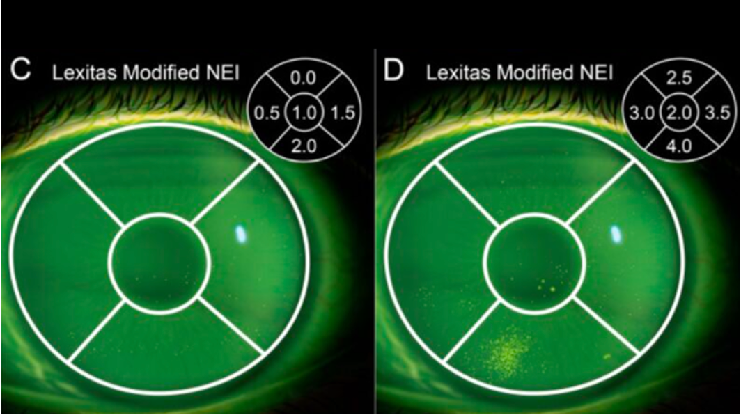 Lexitas Monitors – Focused on Details and the Big Picture | Lexitas